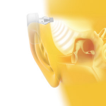 Bone Anchored Hearing Aids | Tampa Bay Hearing and Balance Center